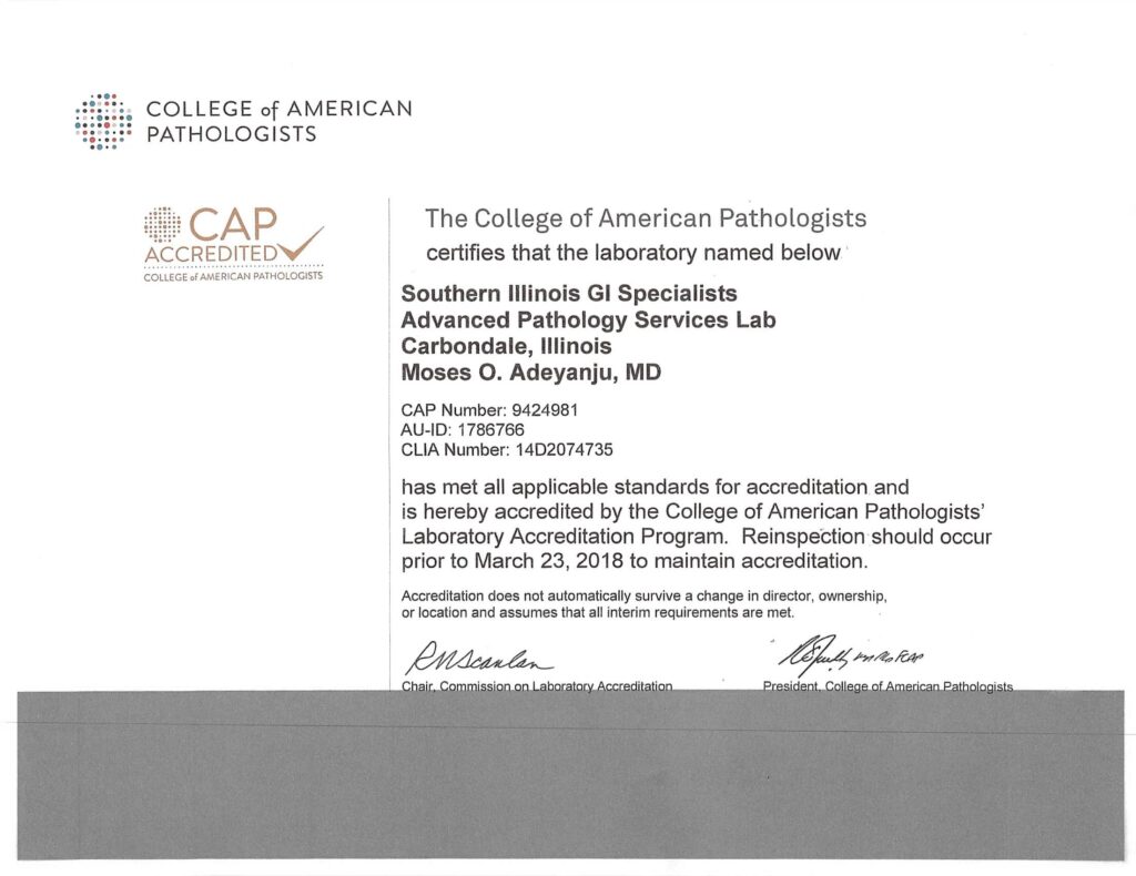 Sigis Carbondale: Trusted GI Specialists in Southern Illinois, IL